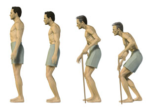 ZZSK - choroba osób młodych